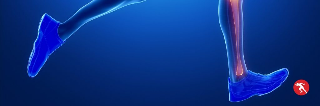 Shin Splints - Sports Physiotherapy Belfast